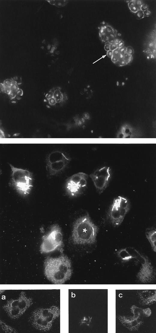 Fusion of Azurophil Granules with Phagosomes and Activation of the ...