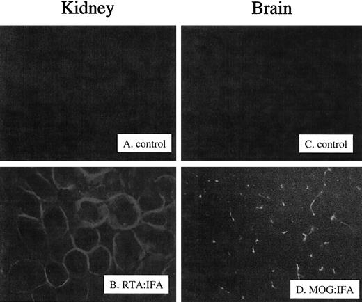 Revisiting Tolerance Induced by Autoantigen in Incomplete Freund’s ...