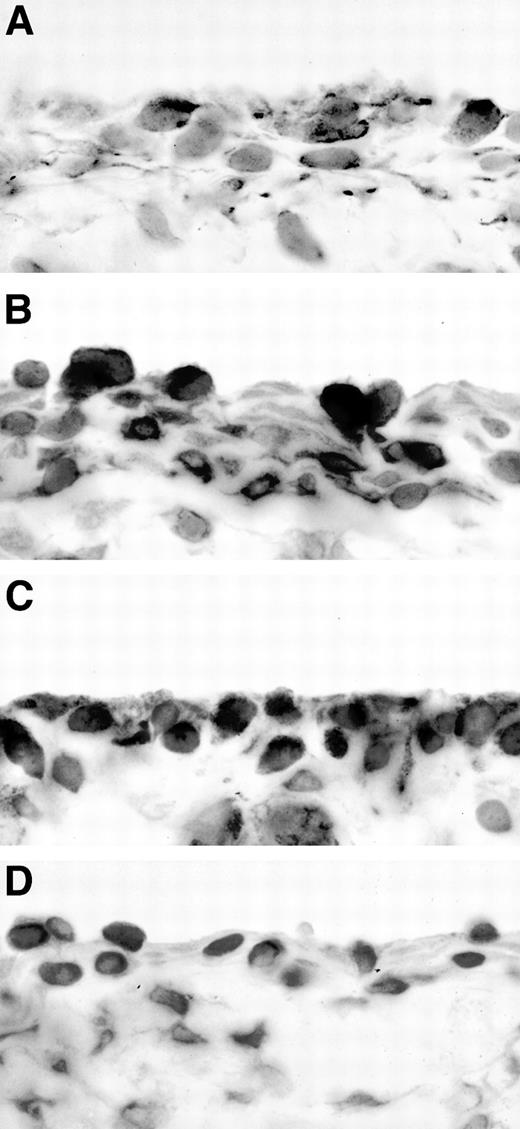 Stat4 Is Expressed in Activated Peripheral Blood Monocytes, Dendritic ...