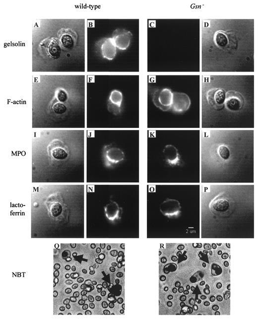 Selective Inhibition Of Igg Mediated Phagocytosis In Gelsolin Deficient