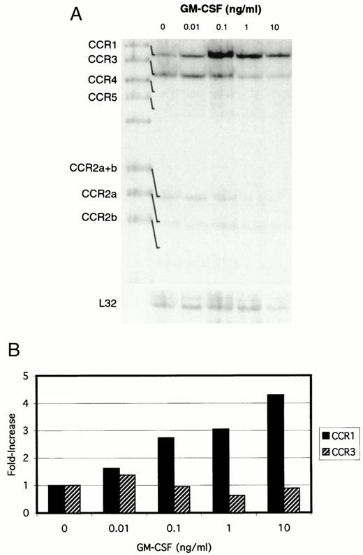 Granulocyte Macrophage Colony Stimulating Factor Up Regulates Ccr1 In
