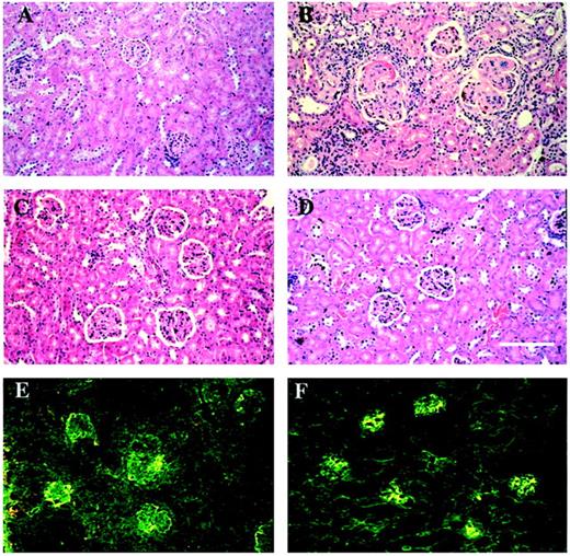 Cutting Edge: Amelioration of Kidney Disease in a Transgenic Mouse ...