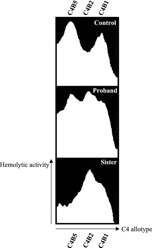 Characterization of a De Novo Conversion in Human Complement C4 Gene ...