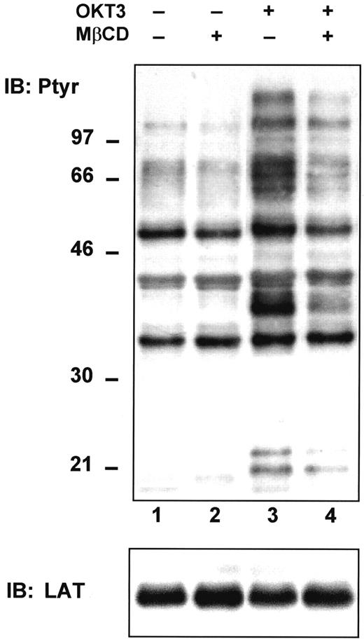 Lipid Raft Heterogeneity in Human Peripheral Blood T Lymphoblasts: A ...