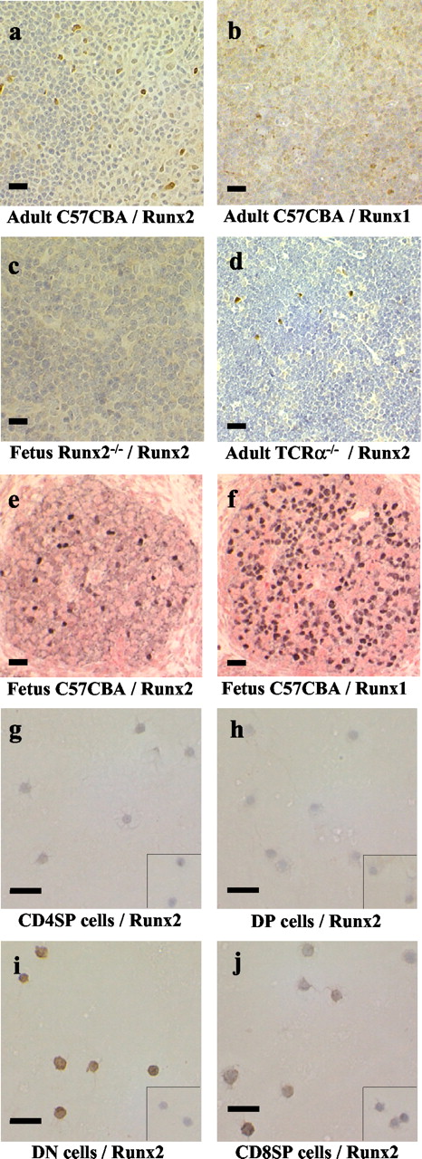Enforced Expression Of Runx2 Perturbs T Cell Development At A Stage Coincident With β Selection1