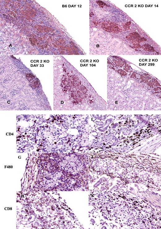 Differential Role of CCR2 in Islet and Heart Allograft Rejection ...