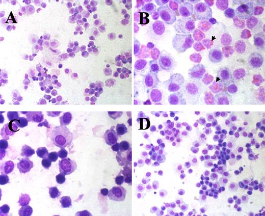 Arthropod-Derived Histamine-Binding Protein Prevents Murine Allergic ...