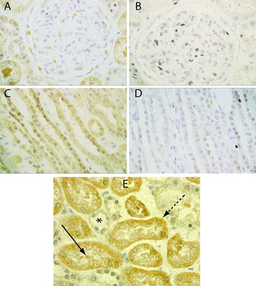 Renal Expression of the C3a Receptor and Functional Responses of ...