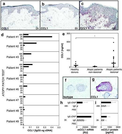 CCL1-CCR8 Interactions: An Axis Mediating the Recruitment of T Cells ...