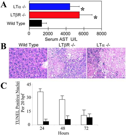 Contribution of the Lymphotoxin β Receptor to Liver Regeneration1 | The ...