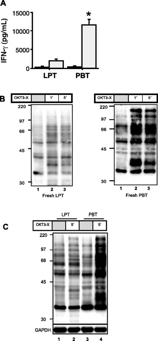 Redox Equilibrium in Mucosal T Cells Tunes the Intestinal TCR Signaling ...