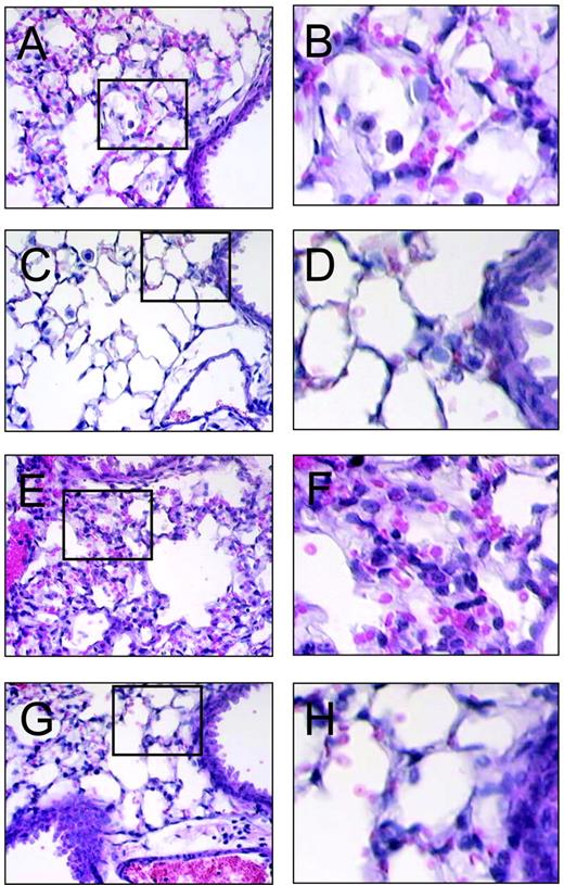 Fas-Mediated Acute Lung Injury Requires Fas Expression on Nonmyeloid ...