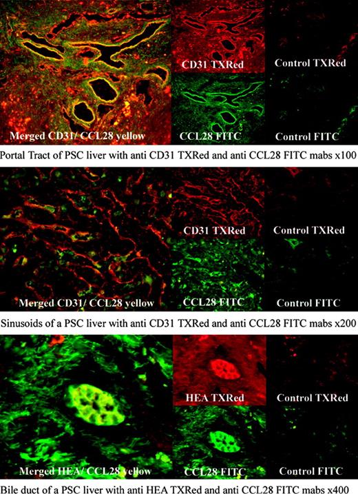 Epithelial Inflammation Is Associated with CCL28 Production and the ...
