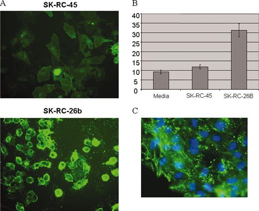 TNF-α Induction of GM2 Expression on Renal Cell Carcinomas Promotes T ...
