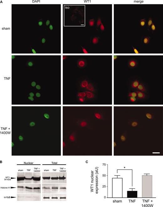 The Transcription Factor Wilms Tumor 1 Regulates Matrix