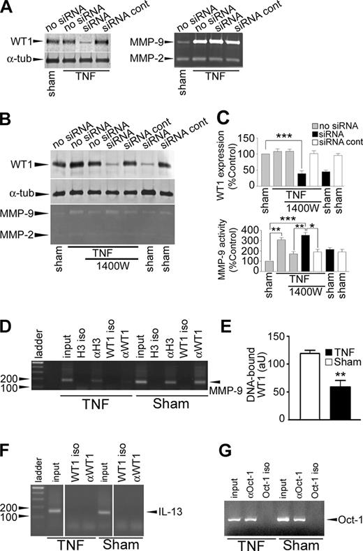 The Transcription Factor Wilms Tumor 1 Regulates Matrix