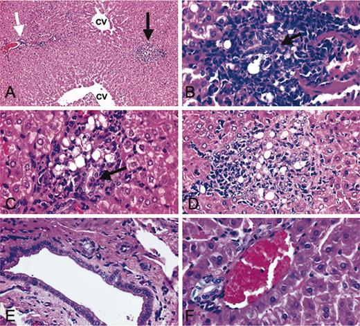 Induction of Primary Biliary Cirrhosis in Guinea Pigs following ...