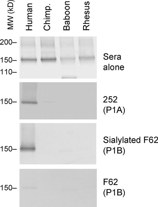 Human Factor H Interacts Selectively With Neisseria Gonorrhoeae And
