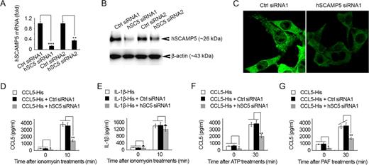 Human SCAMP5, a Novel Secretory Carrier Membrane Protein, Facilitates ...