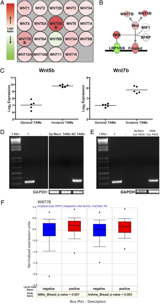 Gene Expression Analysis of Macrophages That Facilitate Tumor Invasion ...