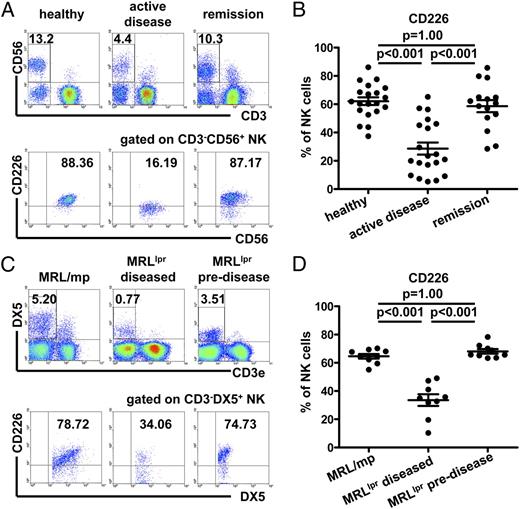 Involvement of CD226+ NK Cells in Immunopathogenesis of Systemic Lupus ...