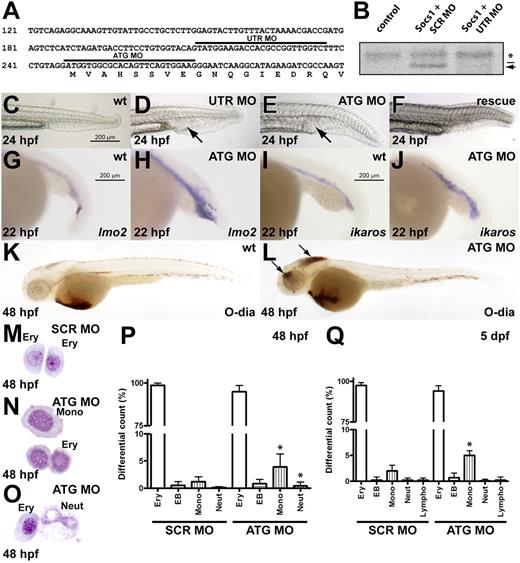 Suppressor Of Cytokine Signaling 1 Regulates Embryonic Myelopoiesis