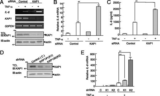 Krüppel Associated Box Associated Protein 1 Negatively Regulates Tnf α