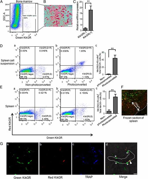 Systemic Circulation and Bone Recruitment of Osteoclast Precursors ...