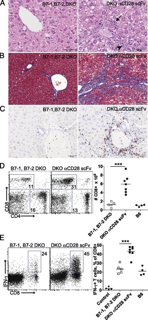 Cutting Edge: Chronic Inflammatory Liver Disease in Mice Expressing a ...