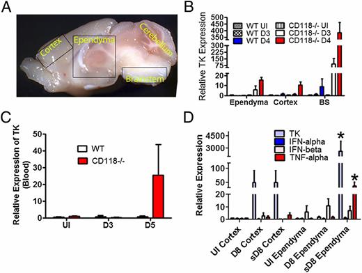 Microglia and a Functional Type I IFN Pathway Are Required To Counter ...