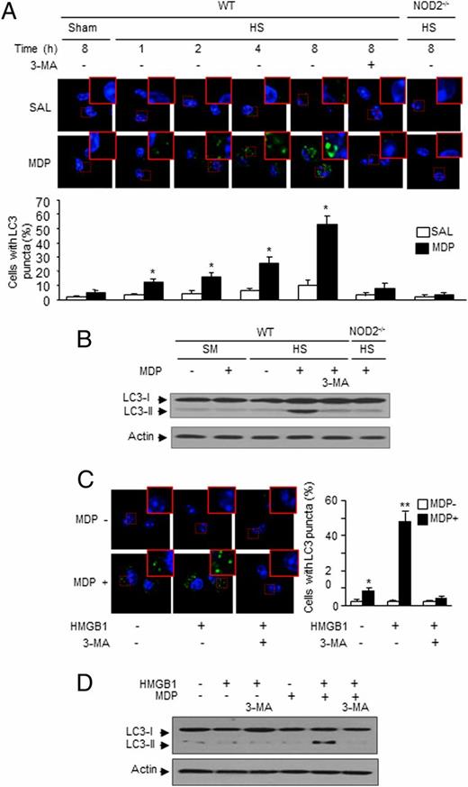 Neutrophils Counteract Autophagy-Mediated Anti-Inflammatory Mechanisms ...