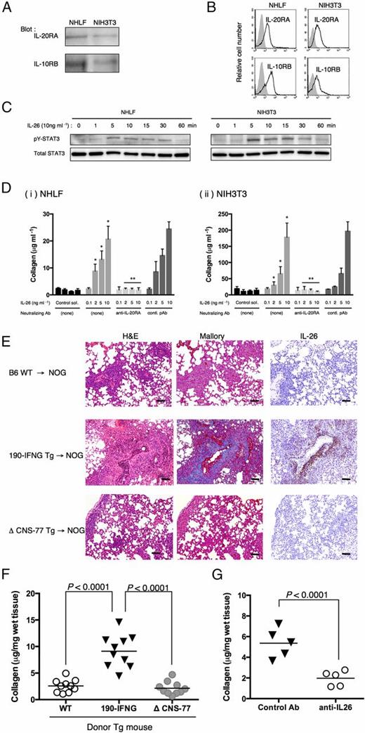 Regulation of Pulmonary Graft-versus-Host Disease by IL-26+CD26+CD4 T ...