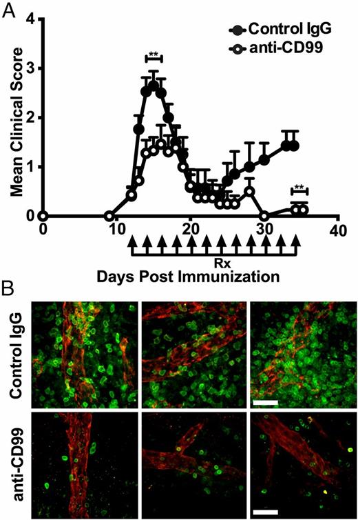 Cutting Edge: CD99 Is a Novel Therapeutic Target for Control of T Cell ...