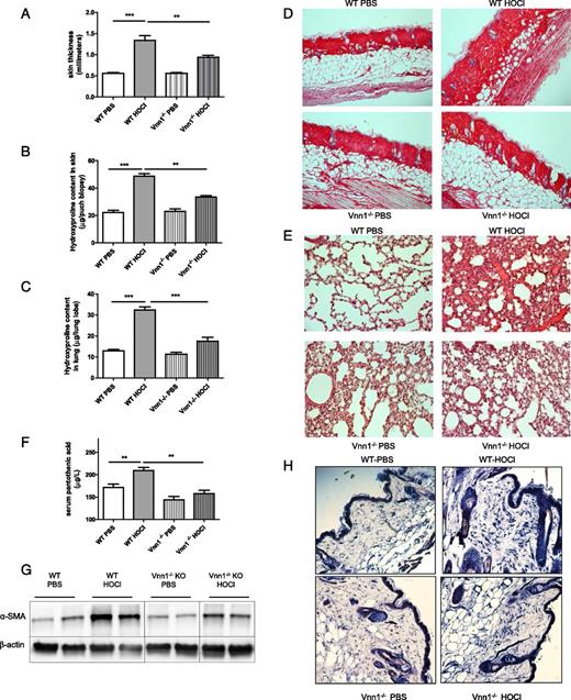 Imbalance of the Vanin-1 Pathway in Systemic Sclerosis | The Journal of ...