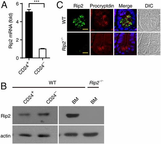 Rip2 Is Required For Nod2 Mediated Lysozyme Sorting In Paneth Cells