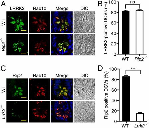 Rip2 Is Required For Nod2 Mediated Lysozyme Sorting In Paneth Cells