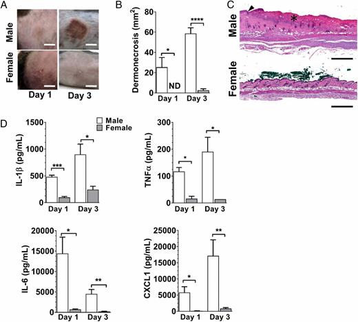 Innate Sex Bias Of Staphylococcus Aureus Skin Infection Is Driven By α
