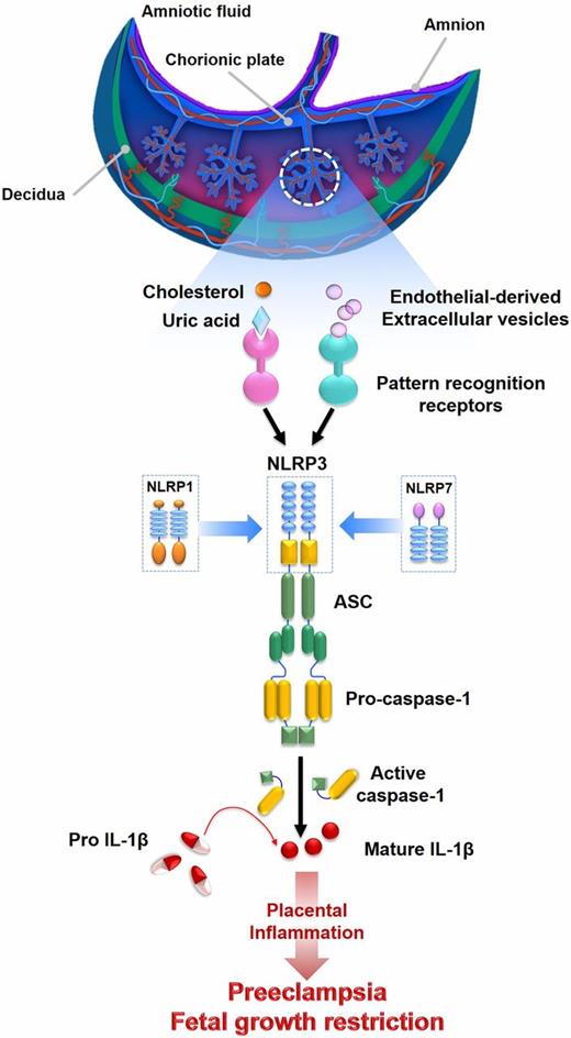Inflammasomes Their Role In Normal And Complicated Pregnancies The