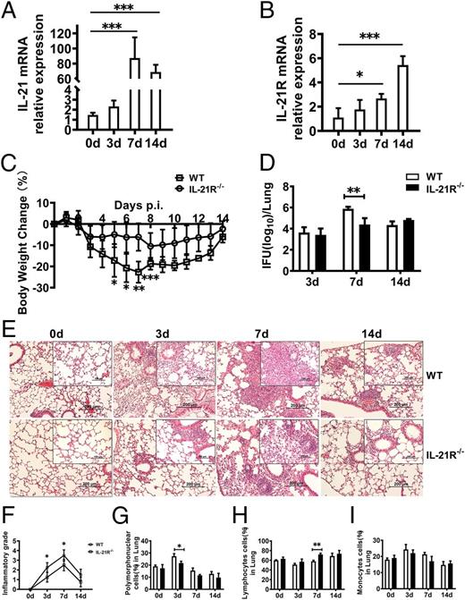 IL-21/IL-21R Signaling Aggravated Respiratory Inflammation Induced by ...