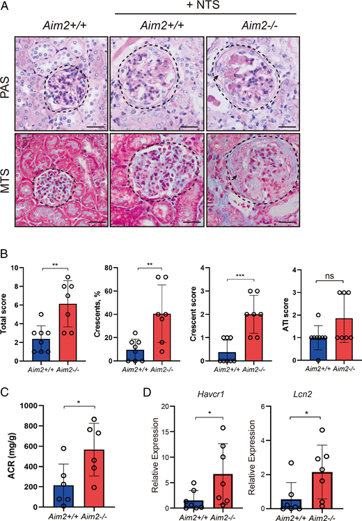 AIM2 Suppresses Inflammation and Epithelial Cell Proliferation during ...