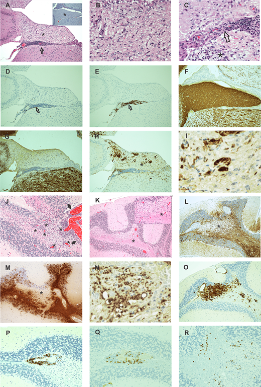 B Cells Drive Mhc Class I Restricted Cd4 T Cells To Induce Spontaneous