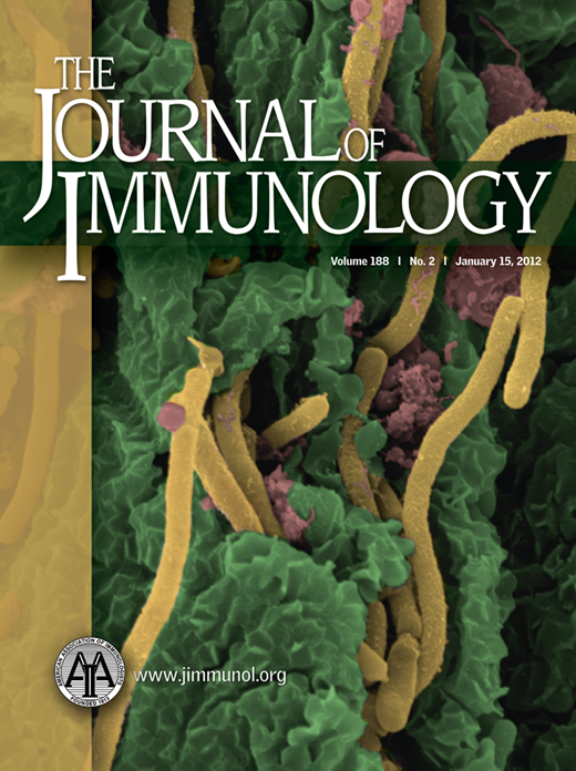 γδ T Cell Homing to Skin and Migration to Skin-Draining Lymph Nodes Is ...