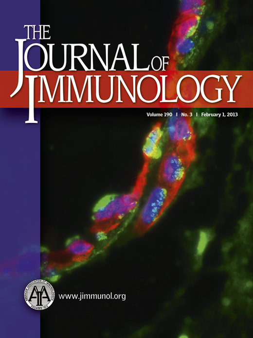 The Crystal Structure of Human Soluble CD14 Reveals a Bent Solenoid ...