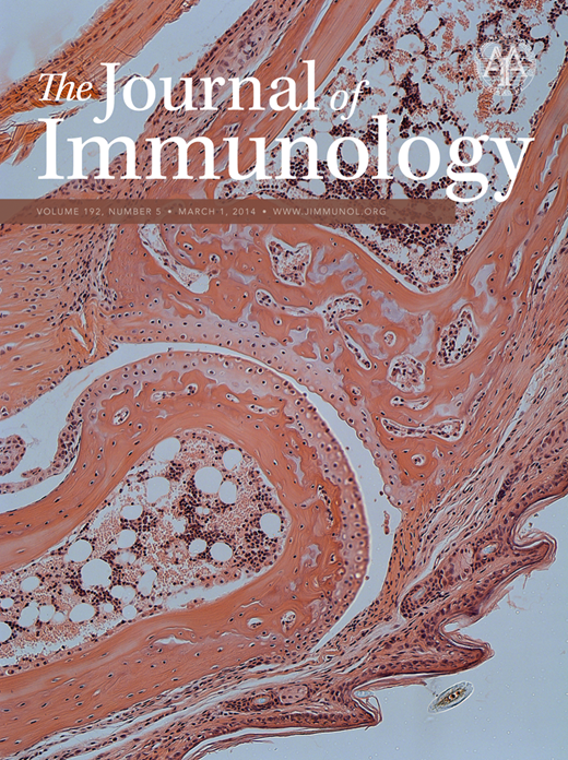 Pillars Article: Abnormal Development of Peripheral Lymphoid Organs in ...